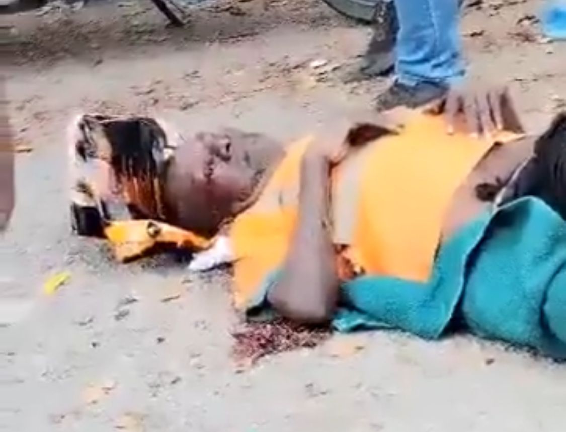 Man’s Eyeball Gouged Out in Drunken Fight in Penang, Malaysia - Wake Up ...