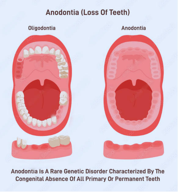 Japanese Biotech Firm Unveils Drug to Regrow Teeth - Wake Up Singapore