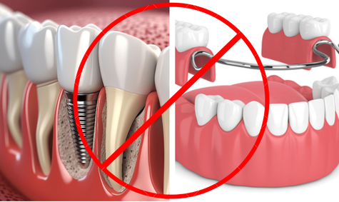 Japanese Biotech Firm Unveils Drug to Regrow Teeth - Wake Up Singapore